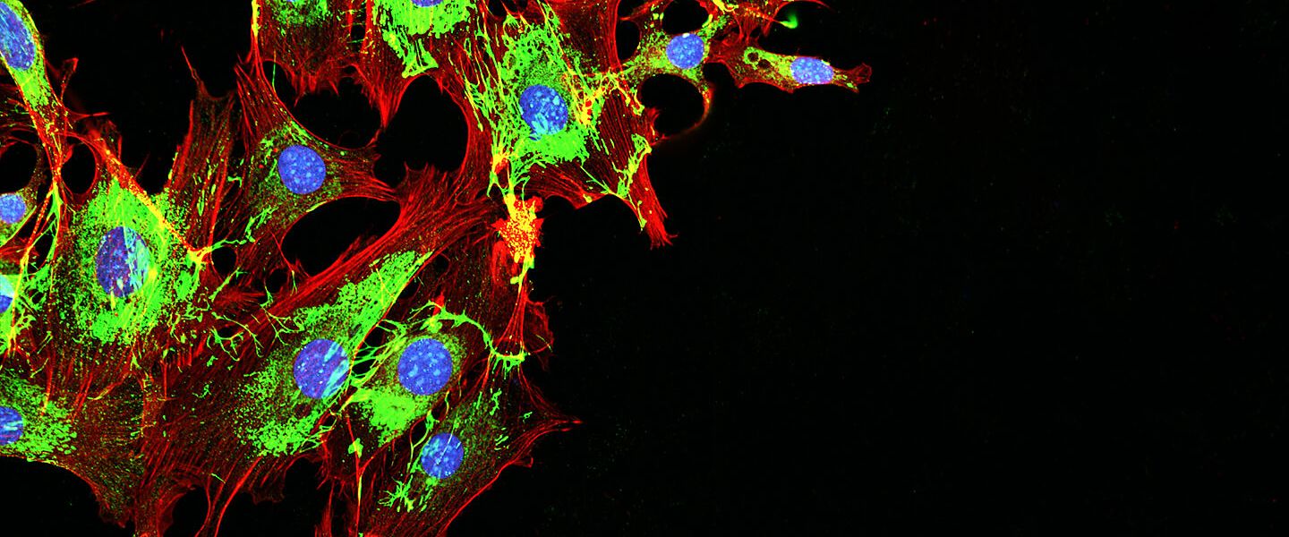 Photonics PPP project REAP